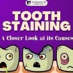 Understanding Tooth Staining: A Closer Look at Its Causes - TheOmniBuzz