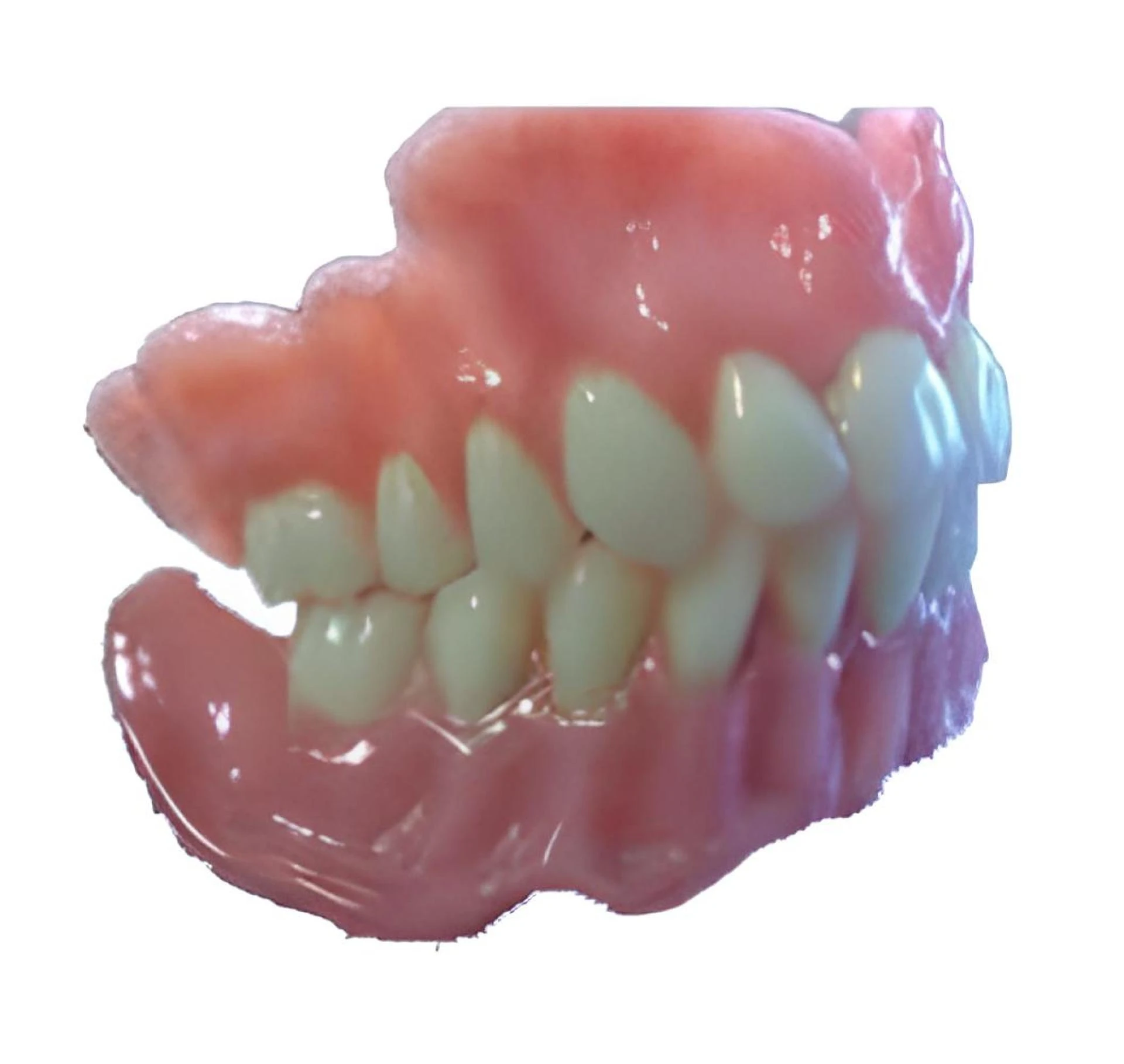 A Comprehensive Guide to Permanent Dentures and Single Tooth Dentures ...