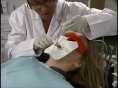 Understanding Gingival Depigmentation Post-Procedure Care - TheOmniBuzz