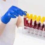 The Vital Role of Lab Draws in Modern Healthcare: A Comprehensive Guide ...